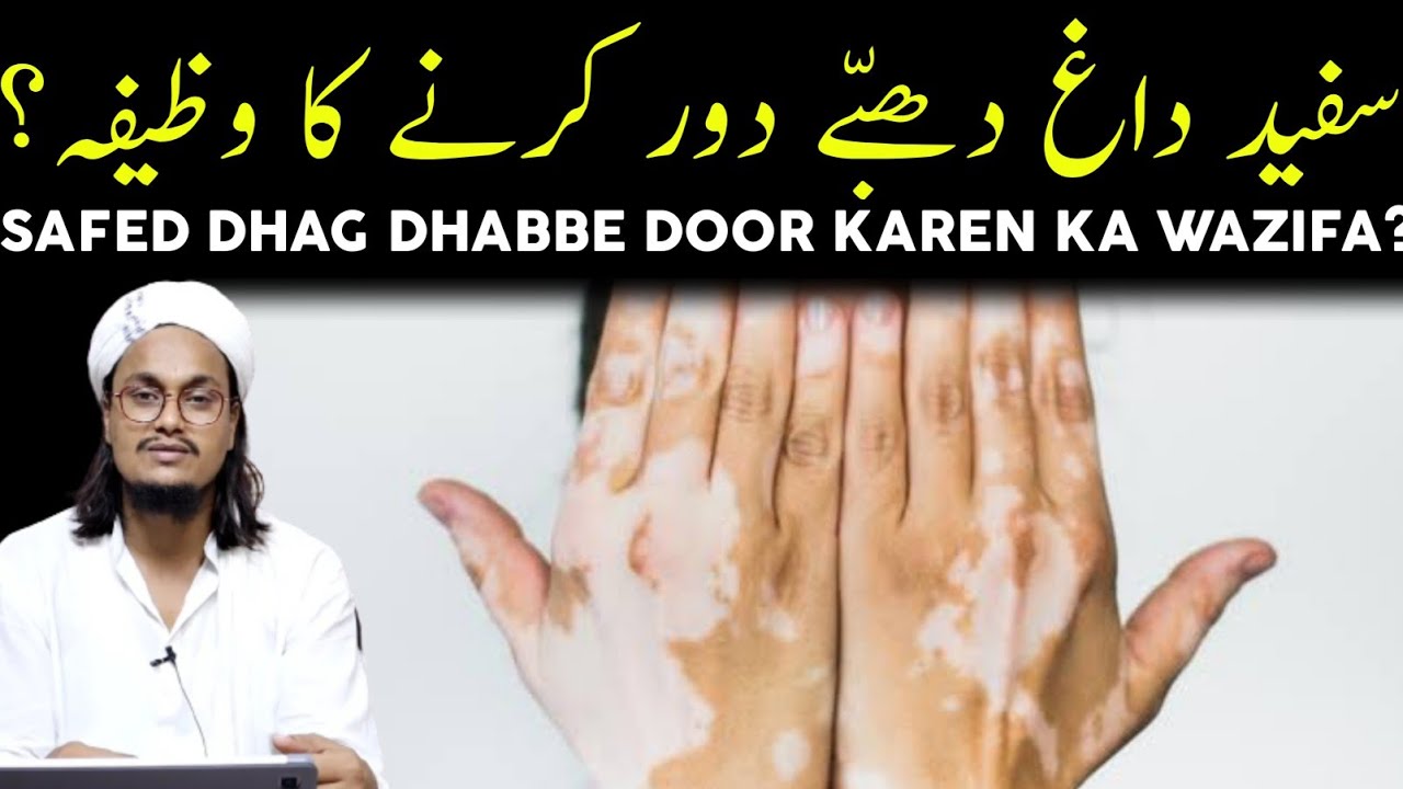 Safed Daag Dhabbe door karne ka Wazifa | Mufti A M Qasmi - YouTube