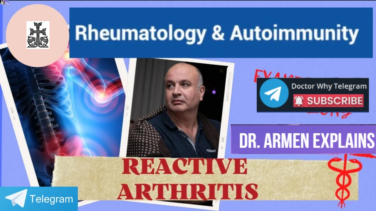 Reactive ARTHRITIS. Reiter's syndrome - YouTube