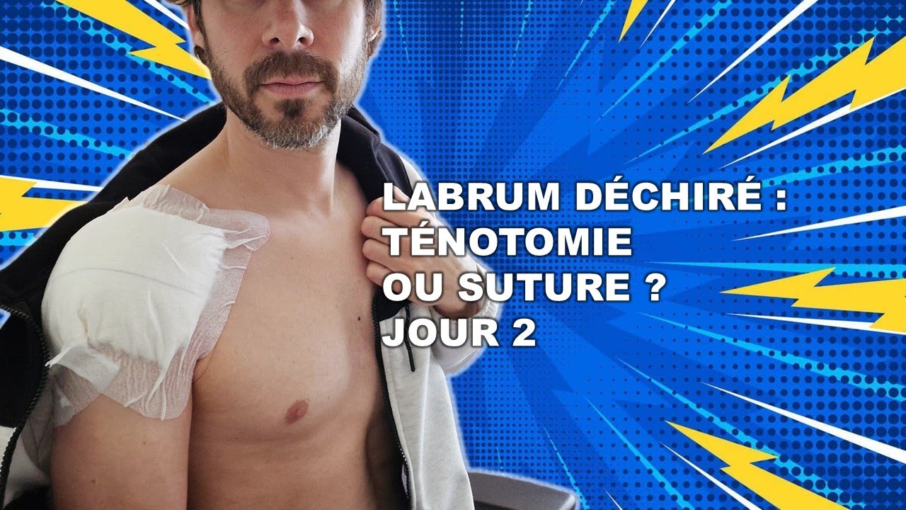 Opération au labrum (ténotomie) - Jour 2 - YouTube
