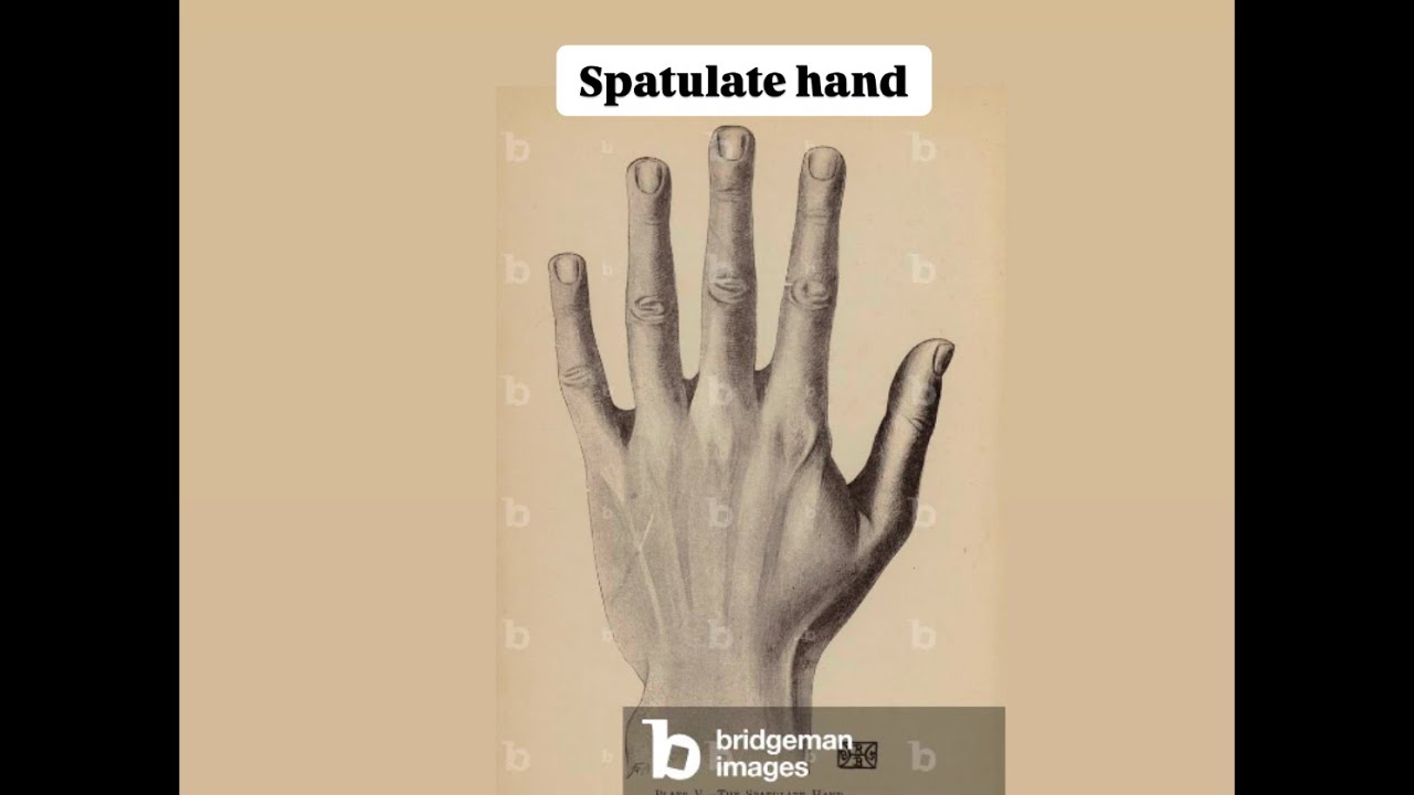Spatulate hand (palmistry) - YouTube