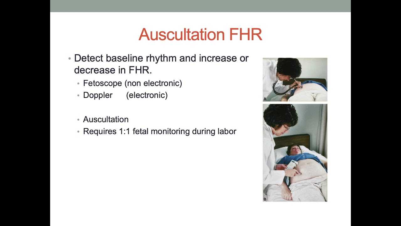 FHR interpretation Part 1 - YouTube