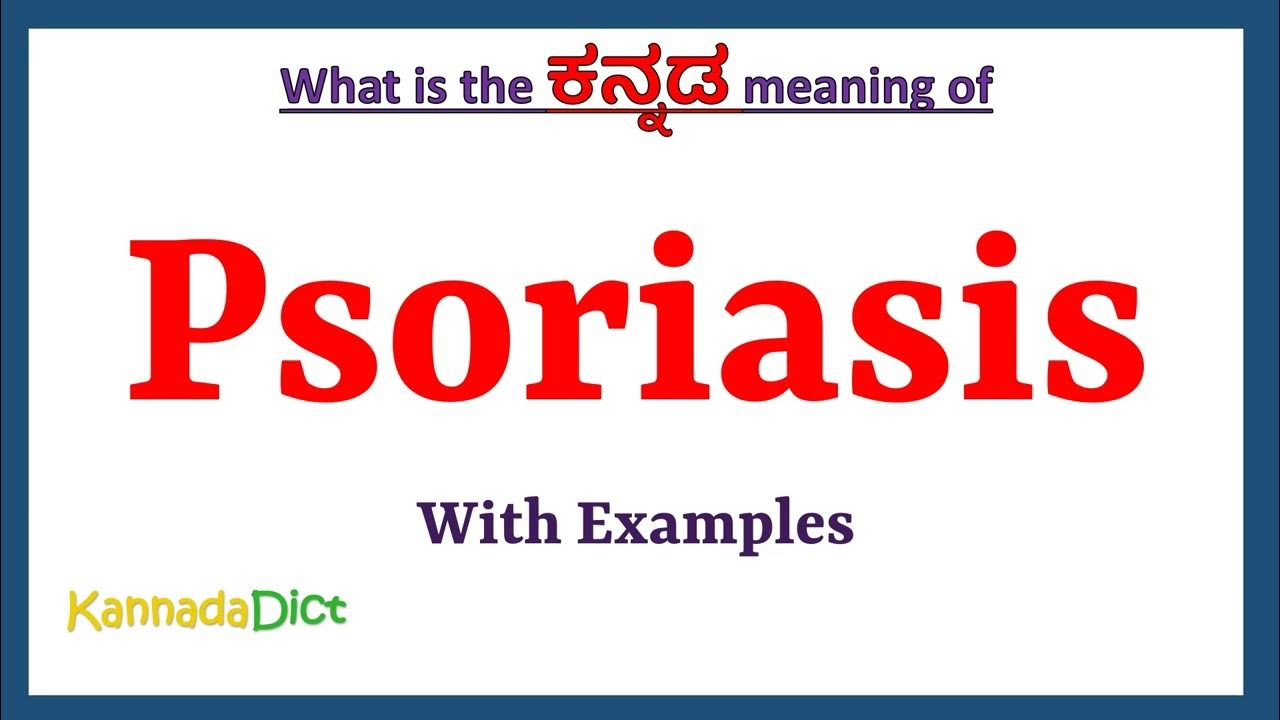 Psoriasis Meaning In Kannada Psoriasis In Kannada Psoriasis In psoriasis-meaning-in-kannada-psoriasis-in-kannada-psoriasis-in