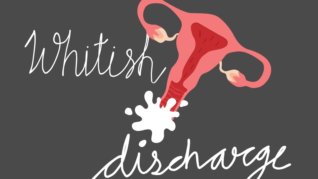 Whitish Vaginal Discharge | Treatment - YouTube