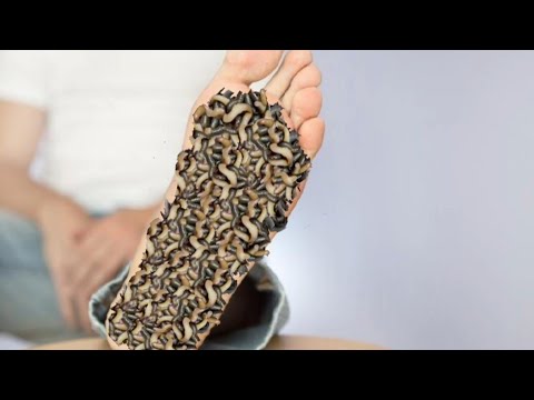 asmr the soles of the feet fungus removals. best relaxing asmr. 2D ...