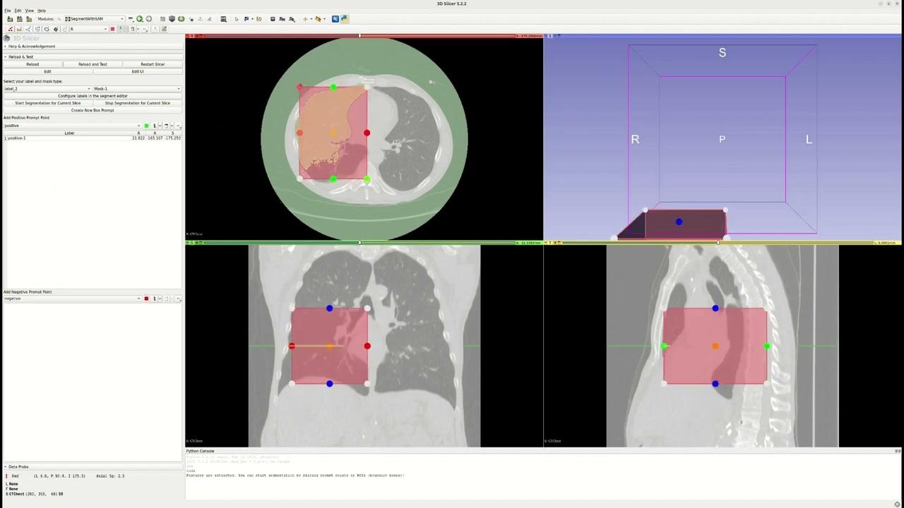 SegmentWithSAM Tutorial (3D Slicer Extension) - YouTube