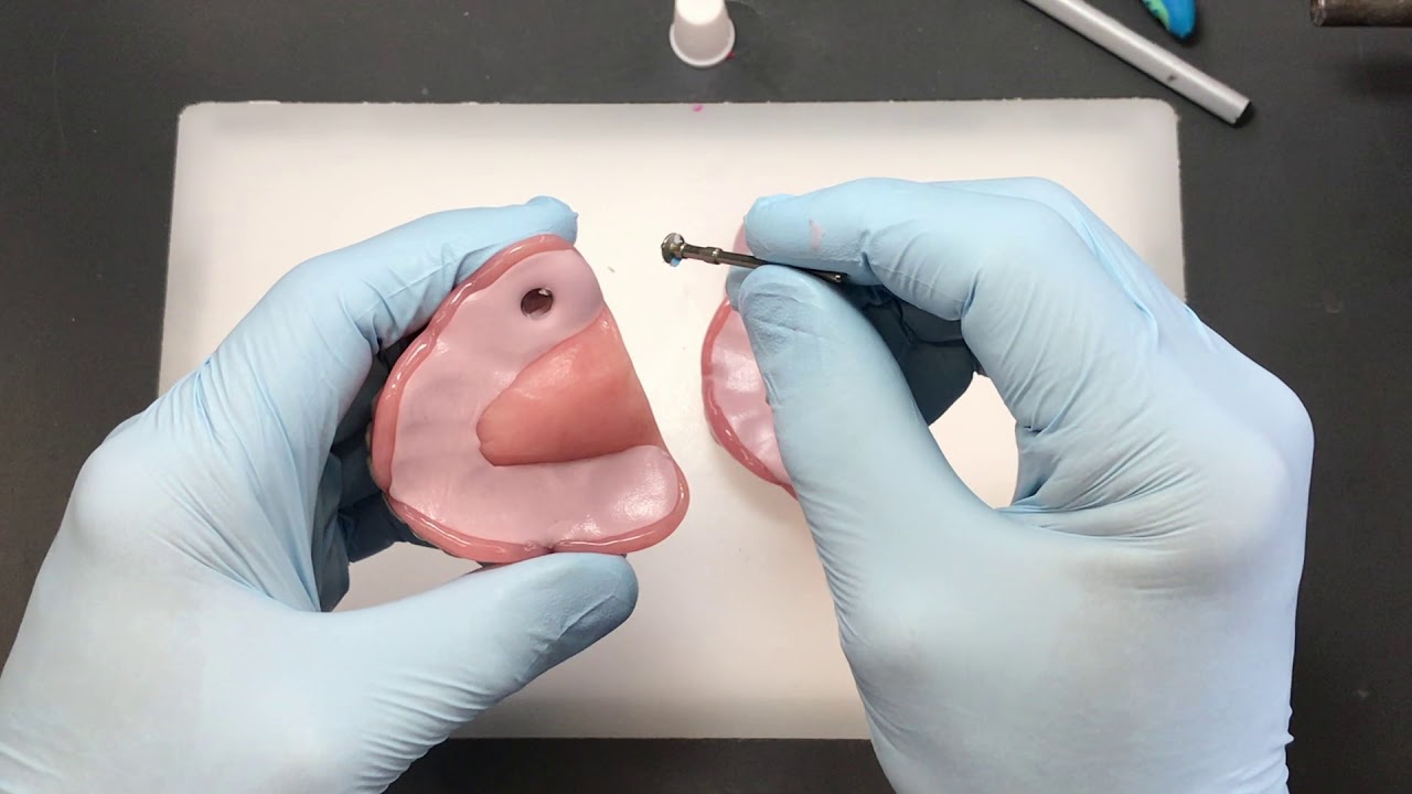 Clinical Remount Cast #1 - YouTube