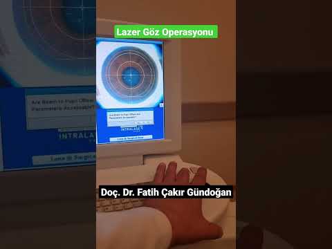 Lazer Göz Operasyonu-LASİK