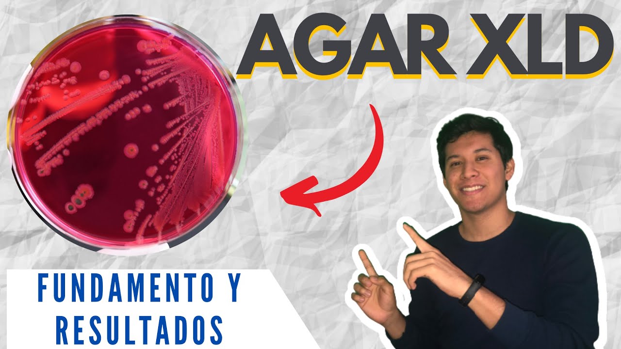 AGAR XLD FUNDAMENTO l XLD AGAR l AGAR XILOSA LISINA DESOXICOLATO l Agar ...