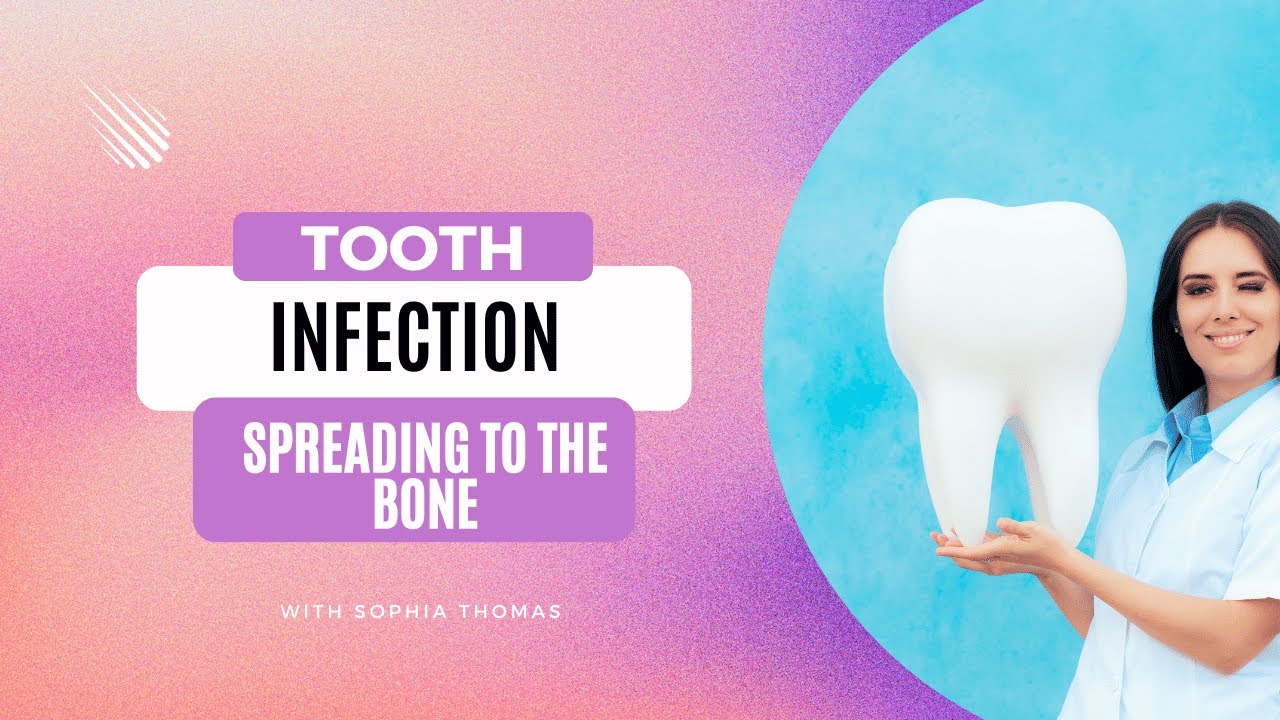 Tooth Infection Spreading to the Bone - YouTube