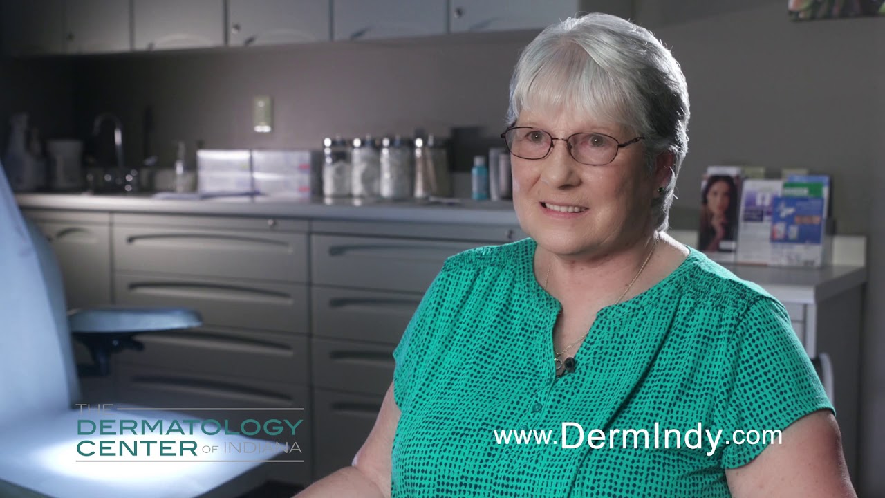 Dermatology Center of Indiana - psoriasis - YouTube
