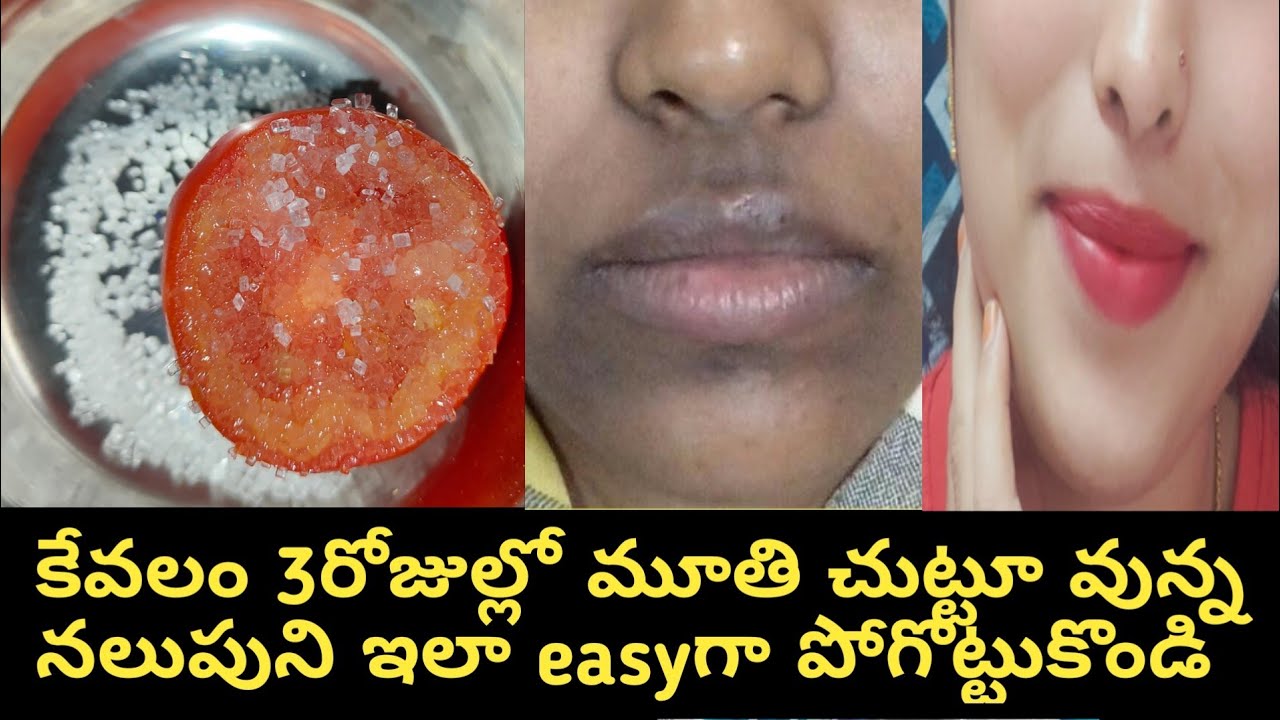 Remove Spots dark Black Patches Around Mouth In 3days Naturally sravs remove-spots-dark-black-patches-around-mouth-in-3days-naturally-sravs