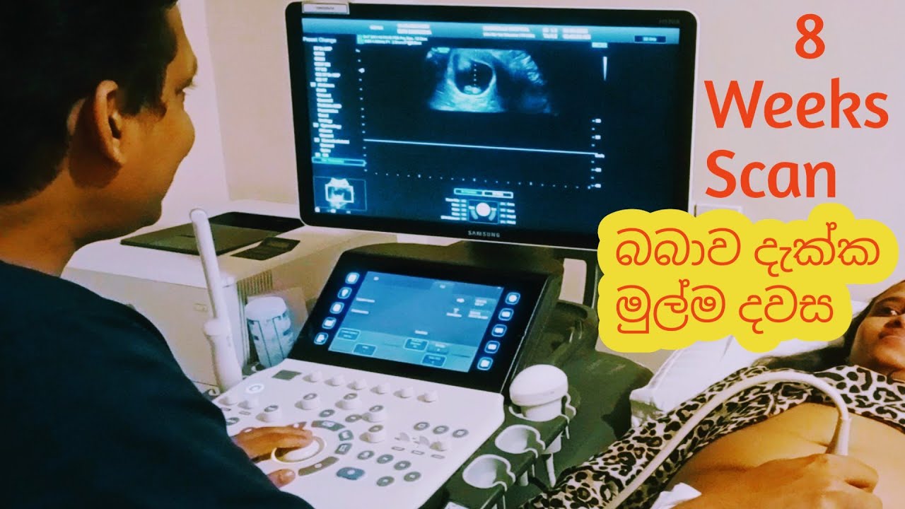8 Weeks Scan l Ninewells Hospital l Dr. Probhodana Ranaweera l බබාගේ ...