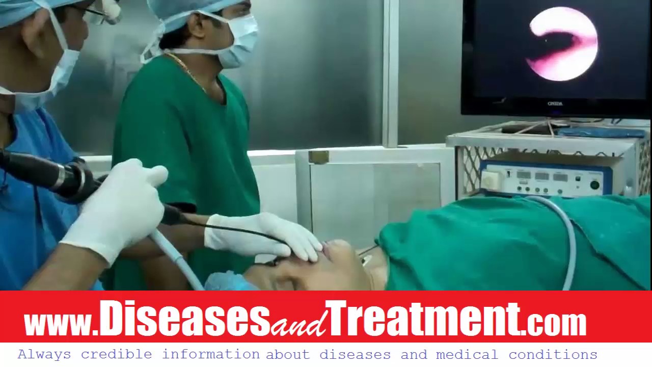 Duodenoscopy Endoscopy Causes Diagnosis Symptoms Treatment Prognosis Youtube