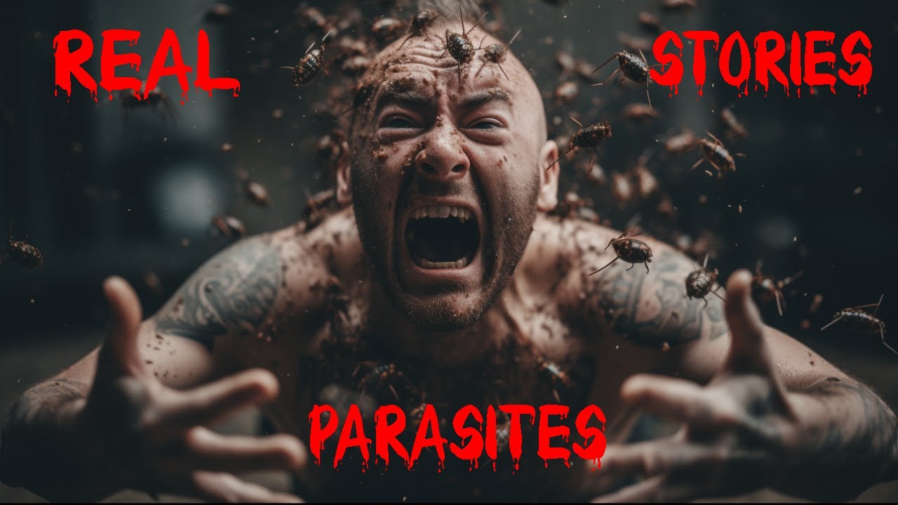 PARASITE HORROR STORIES - YouTube