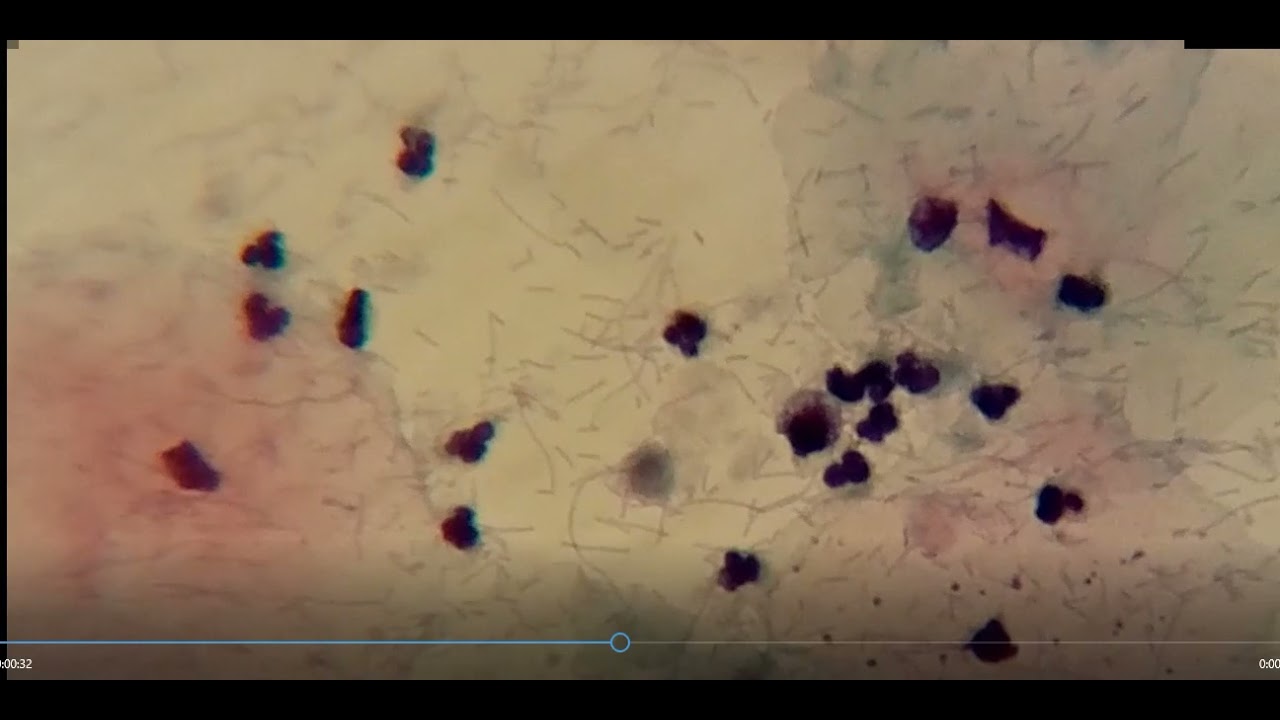 Mg. Carlos Hugo García Vásquez Especialista en Citología LEPTOTHRIX ...