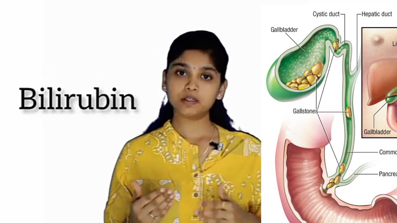 Gall bladder stone | cholelithiasis | causes | symptoms | treatment ...