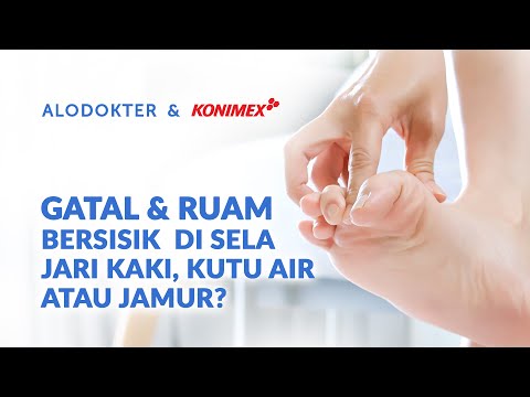 Gatal & Ruam Bersisik di Sela Jari Kaki, Kutu Air atau Jamur?