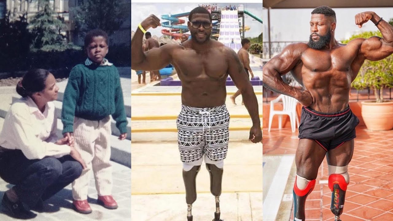 Growing Up without Legs with Bionic Body - YouTube