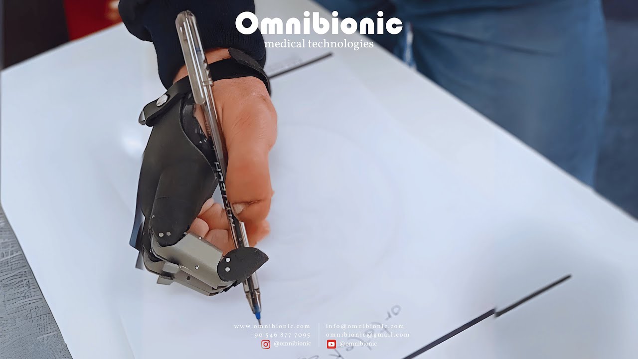 PMCFinger | Mechanical Finger Prosthestics | Bionic Finger | Omnibionic ...