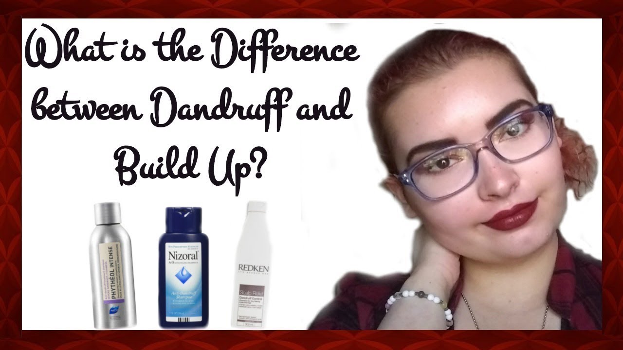 Scalp Build Up vs. Dandruff | Crowned Goddess - YouTube