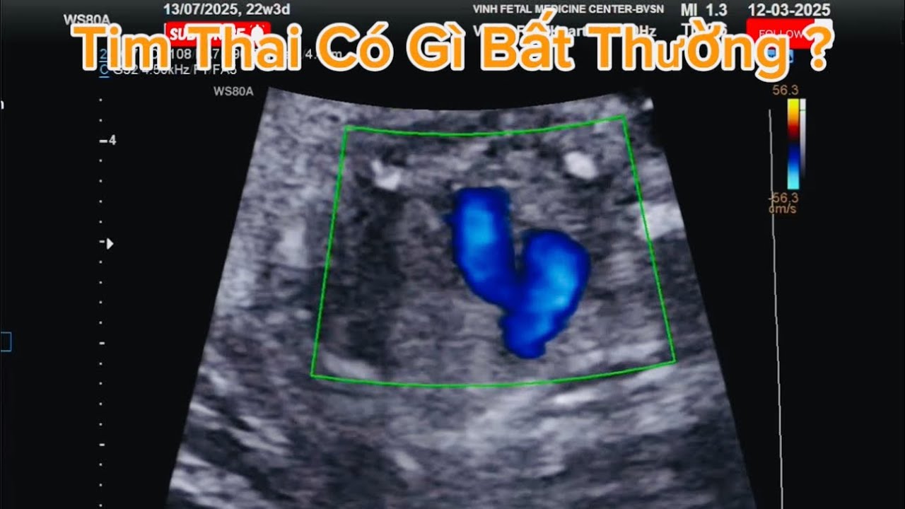 Tim thai có gì bất thường ? - khó !- - YouTube