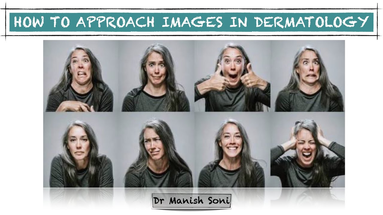 HOW TO APPROACH IMAGE BASED QUESTIONS IN DERMATOLOGY - YouTube