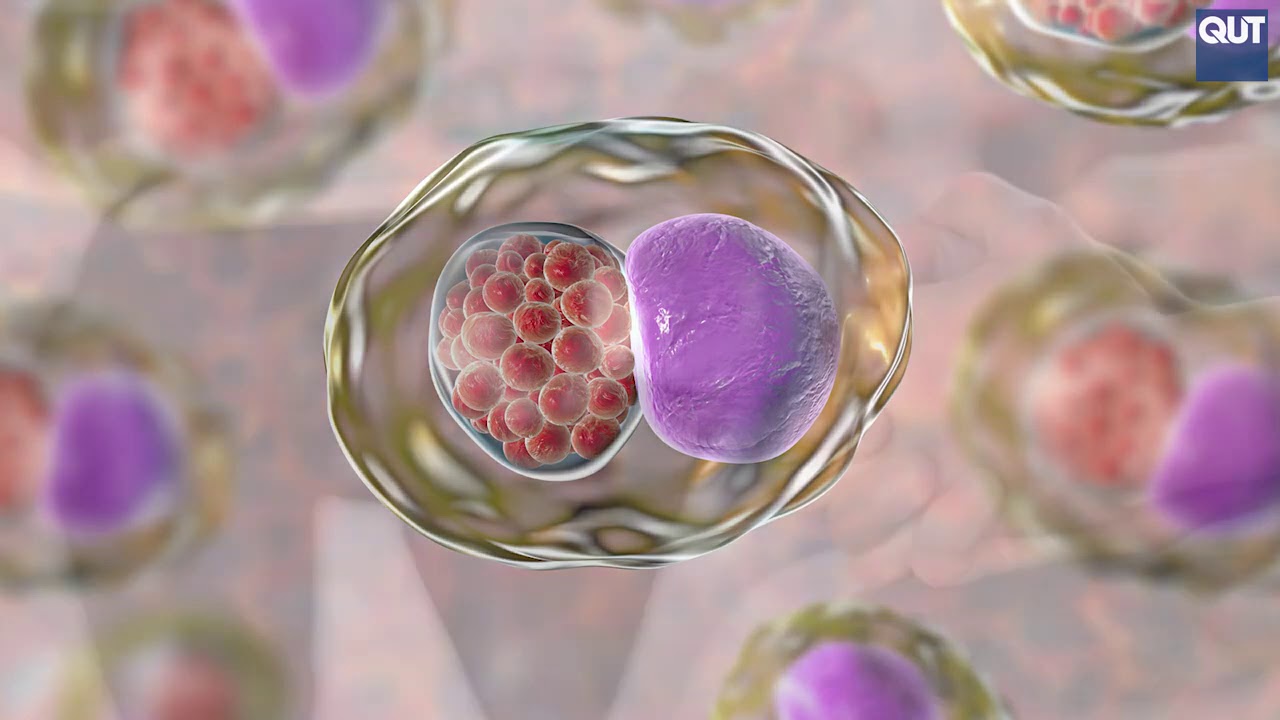 Chlamydia link to male infertility | Hudson Institute - YouTube
