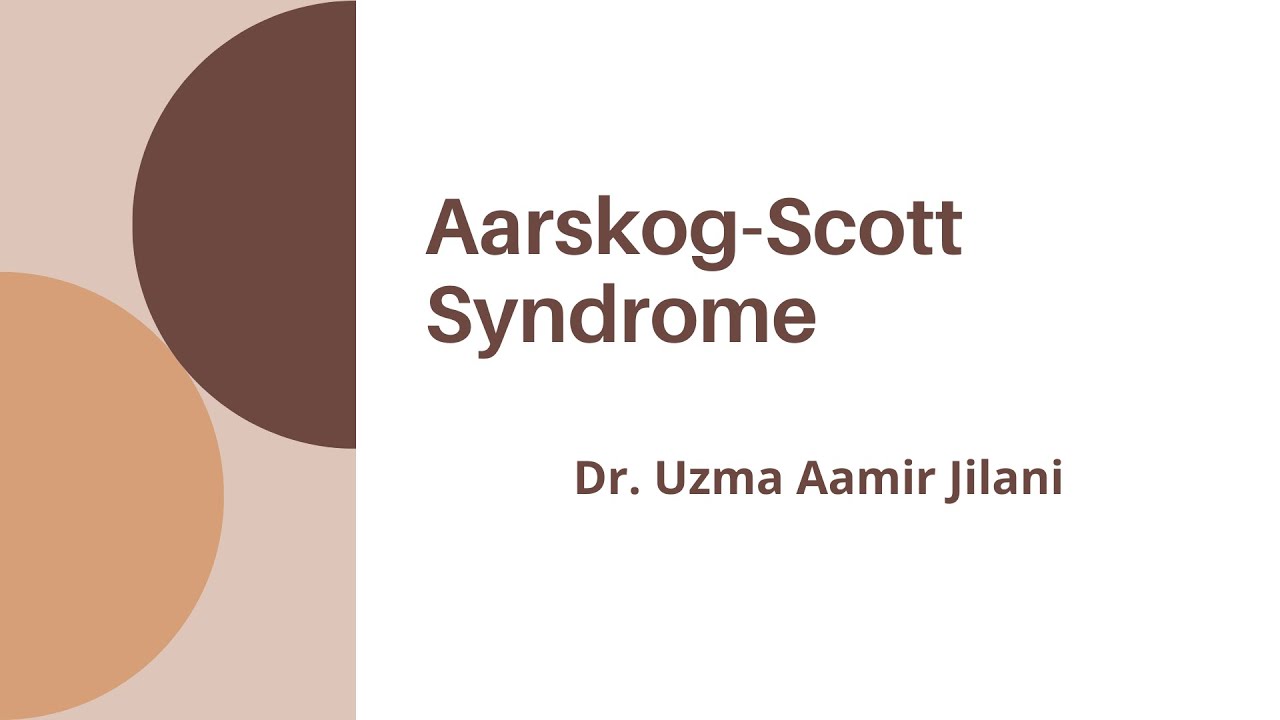 WHAT IS AARSKOG SYNDROME | CLINICAL MEDICINE | MBBS REVISION GUIDE ...