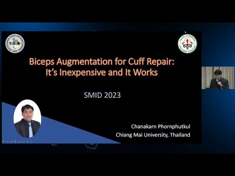 My way for Biceps SCR : simple & inexpensive - YouTube