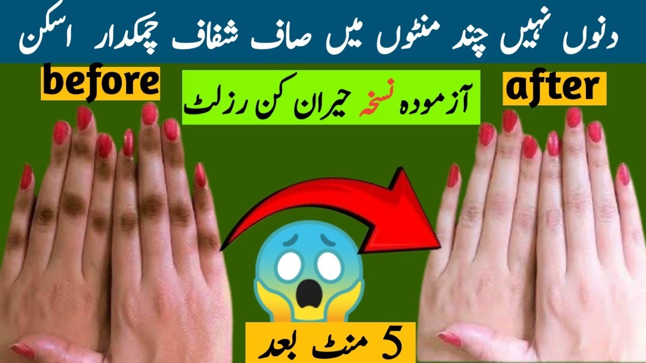 Hands Feet Whitening Treatment | Homemade Foot whitening DIY|Best ...