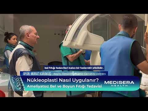 Lazer Nükleoplasti Yöntemi Nasıl Uygulanır? Op. Dr. Murat KARAKUŞ!