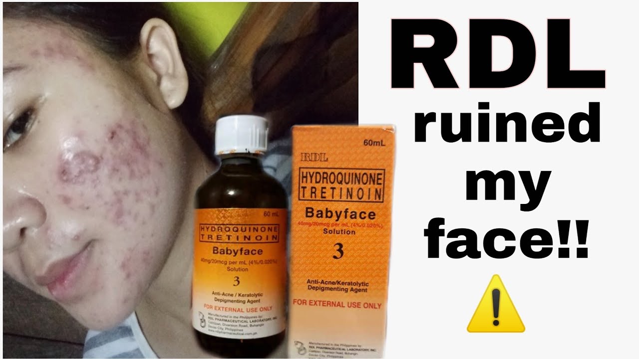 Rdl Baby Face Toner Ingredients at Dustin Richards blog