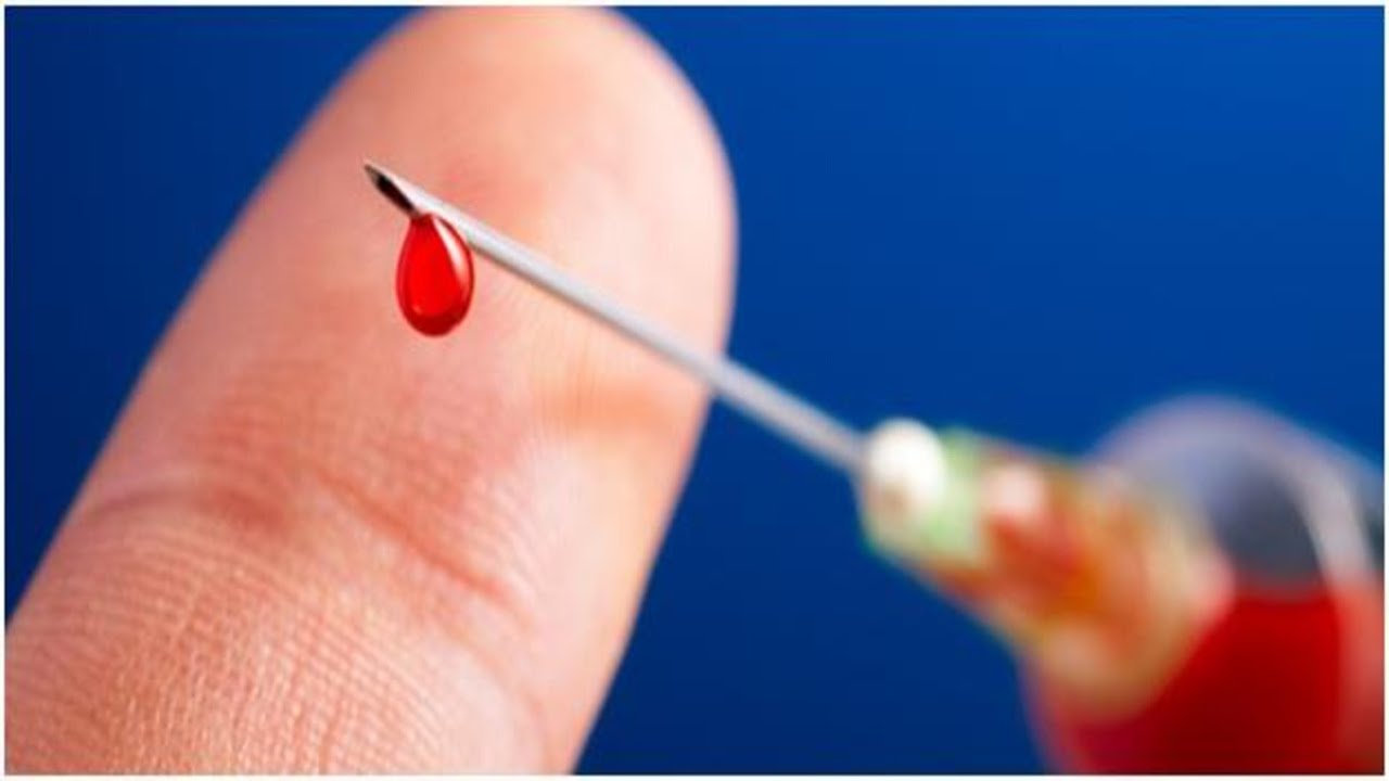 PHYSIOLOGICAL ACTIONS OF BODY FLUIDS IN TCM - YouTube