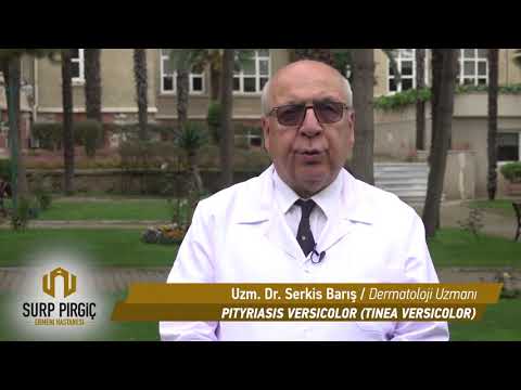 Pityriasis Versicolor | Uzm. Dr. Serkis Barış