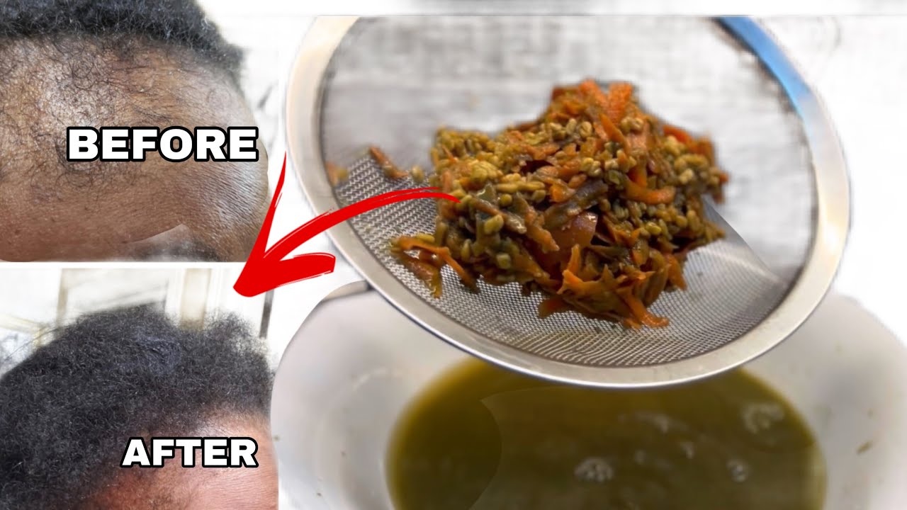 No joke! DO THIS ONCE A WEEK FOR FASTER HAIR GROWRH! June 12, 2024 ...