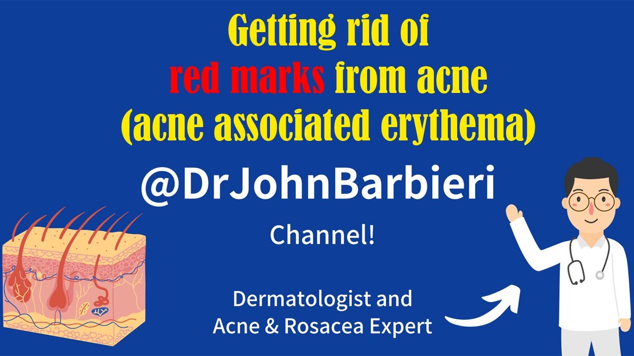 Fix acne red marks | Dermatologist explains in 3 mintues - YouTube
