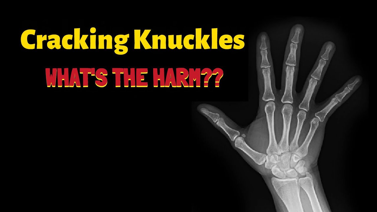 Is Cracking Your Knuckles Dangerous? - YouTube