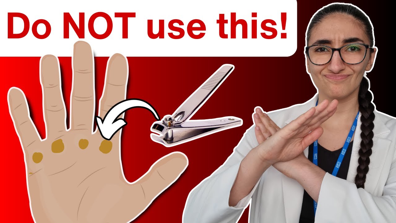 How to remove hand callus (NOT nail clippers or blades!) - YouTube