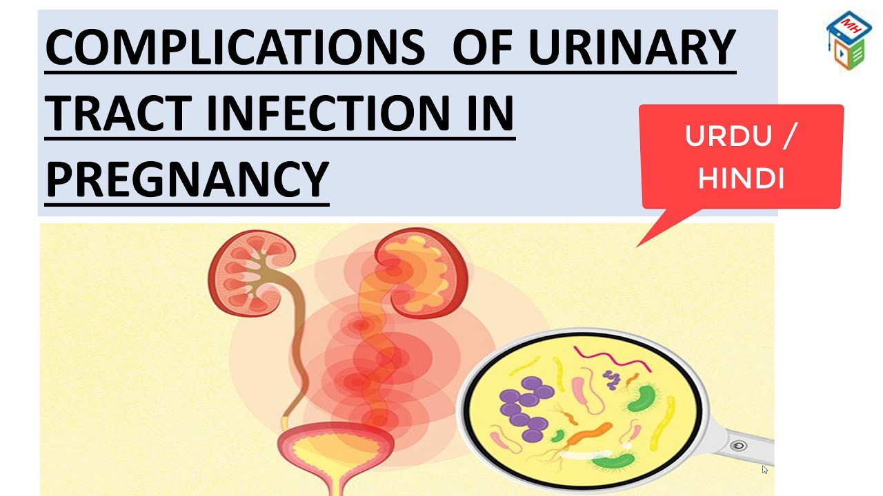 URINARY TRACT INFECTION PART2|COMPLICATIONS OF UTI IN PREGNANCY|Y IT IS ...