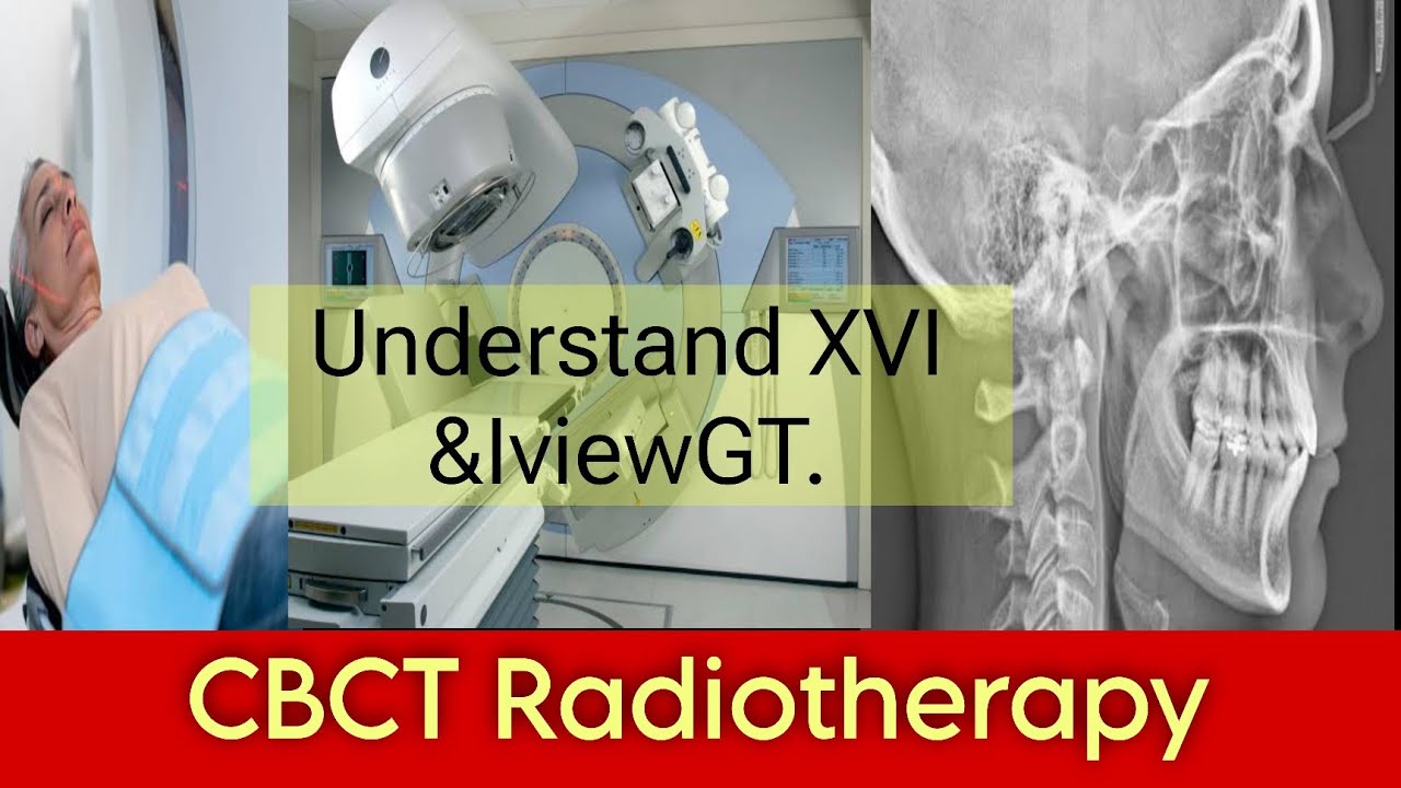Understand XVI & IviewGT || Radiotherapy || Verification by CBCT # ...