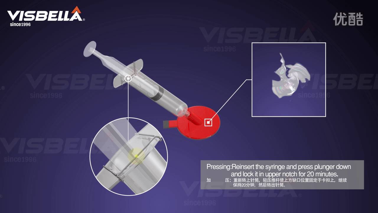 Visbella windscreen repair kit - YouTube