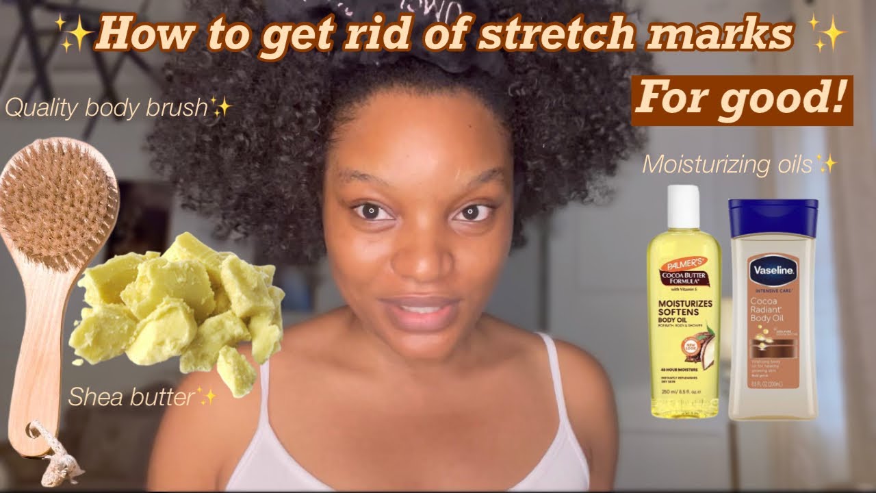 *very detailed* How to get rid of stretch marks for good |no more ...