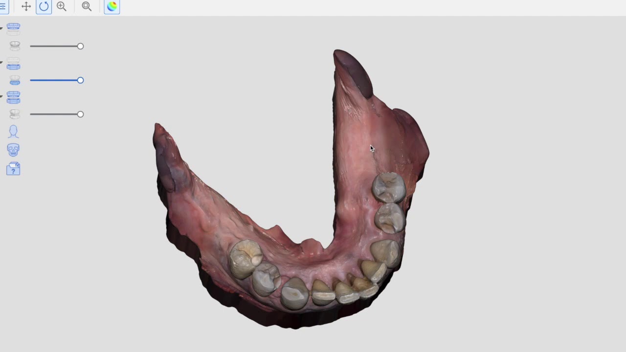Mandibular Anatomy - YouTube