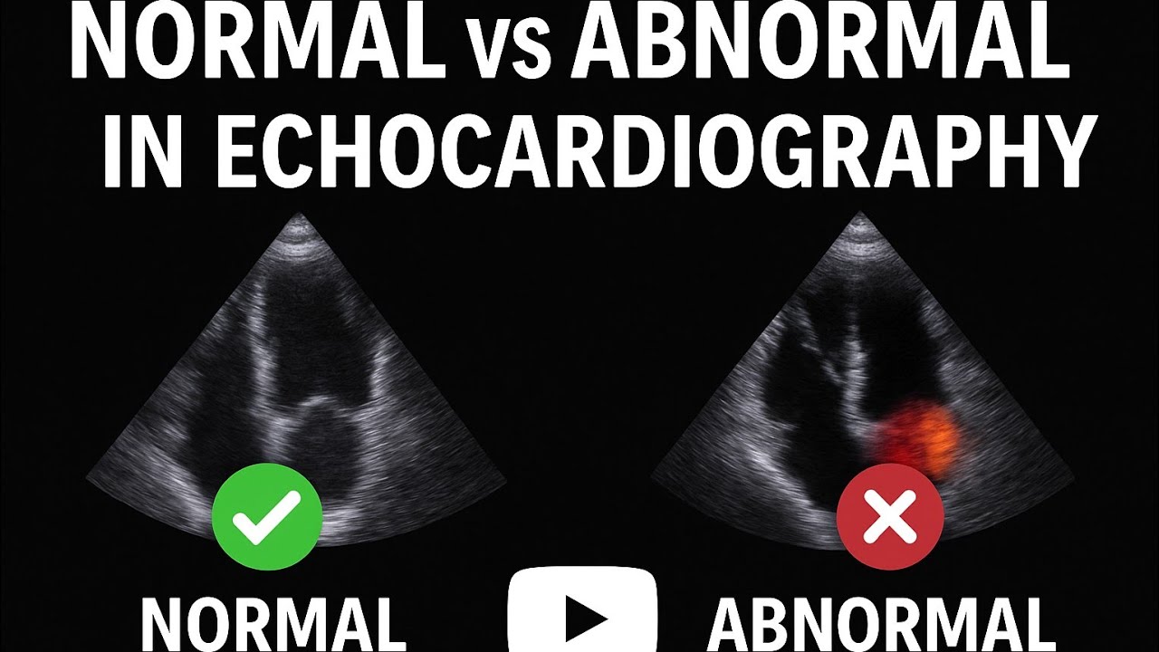 Normal vs Abnormal in Echocardiography with a Detailed guide of all ...