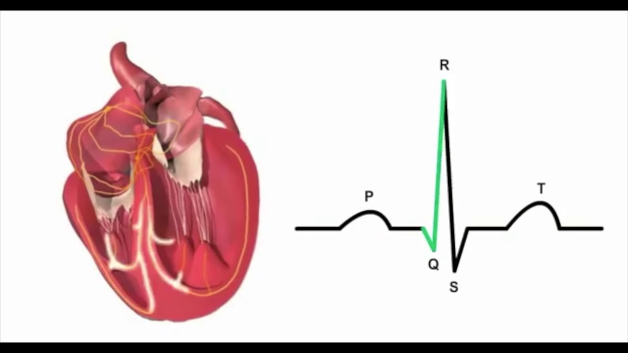 CTCAG Part 5 ECG gating - YouTube