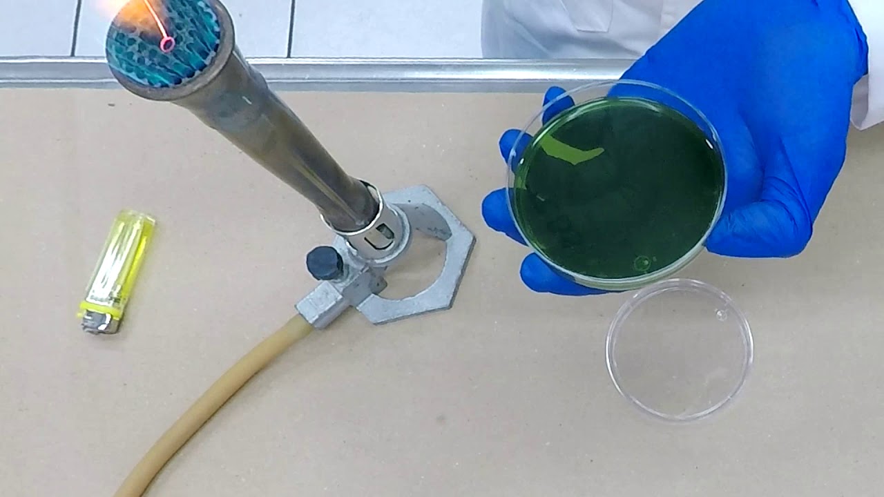 Procedimiento de un coprocultivo - YouTube