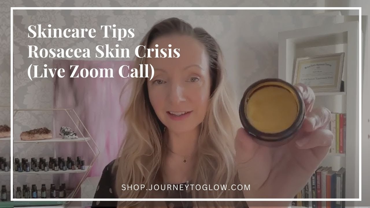 Skincare Tips For A Rosacea Skin Crisis (Live Zoom Call) - YouTube