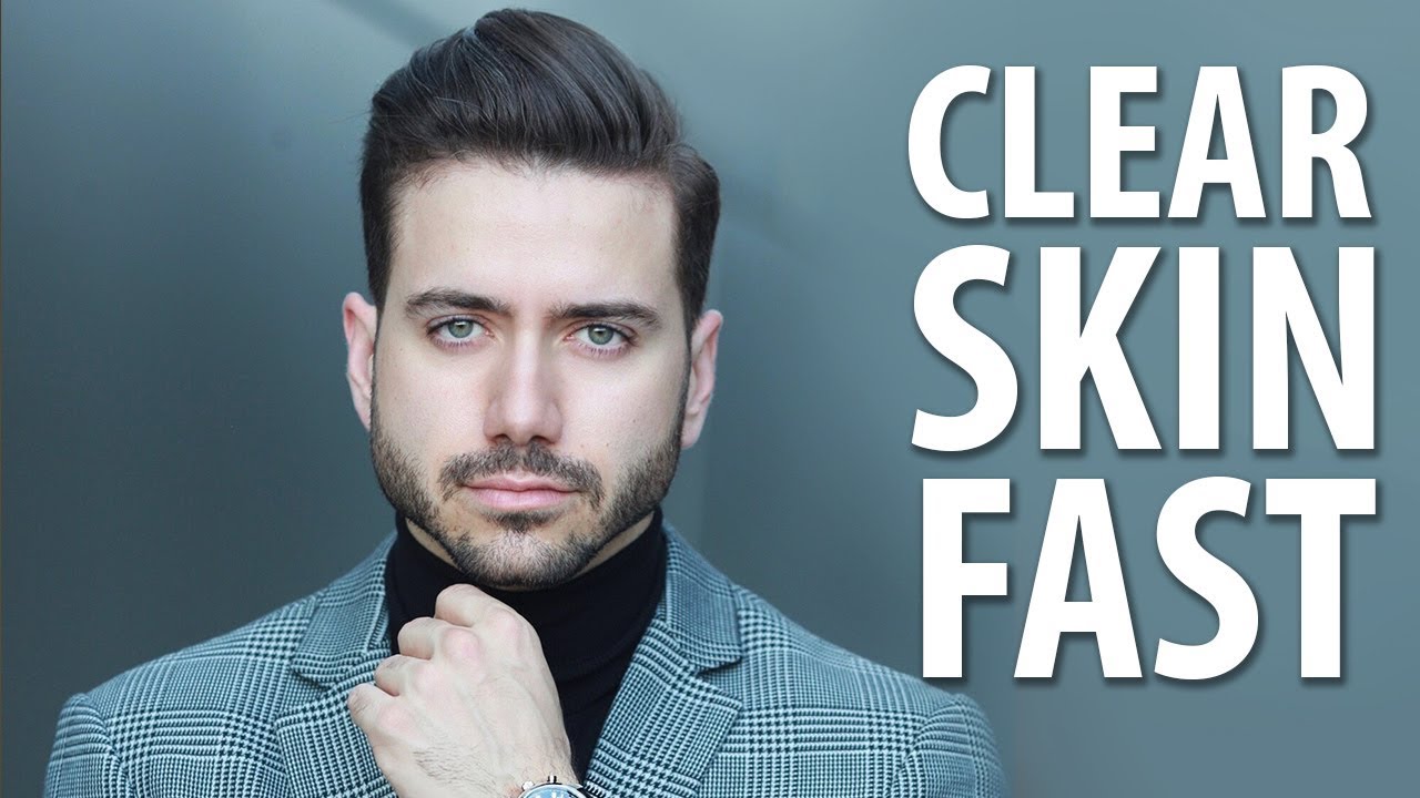 HOW TO GET CLEAR SKIN FAST - Men's Skincare Routine - ALEX COSTA