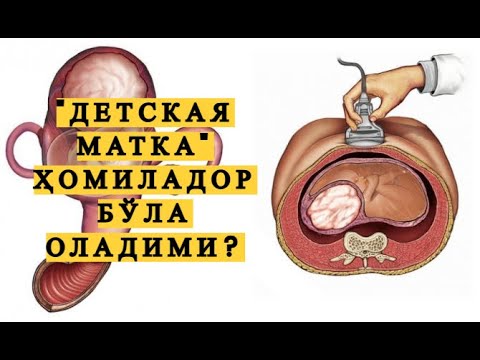БАЧАДОН КИЧИКЛИГИ (ДЕТСКАЯ МАТКА) УЗИ, ҲОМИЛАДОР БЎЛИШИ