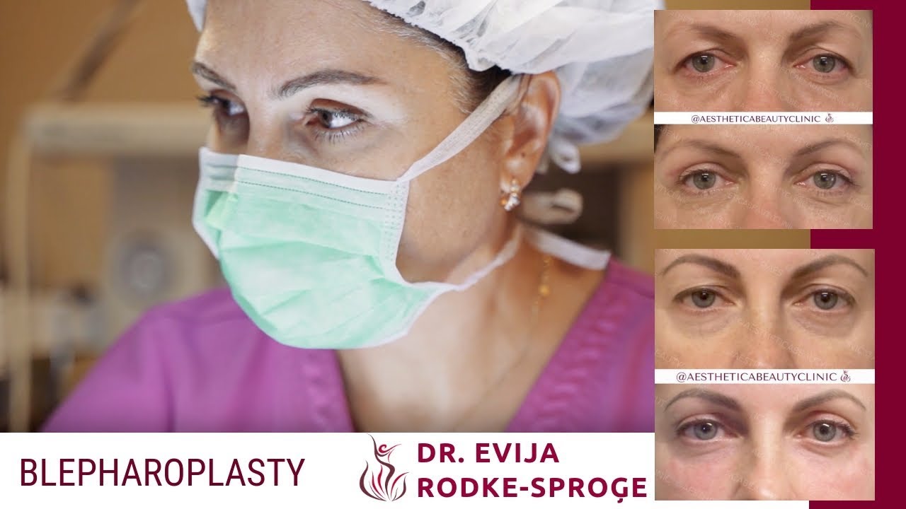 Blepharoplasty: Dr. Evija Rodke Sproģe - YouTube